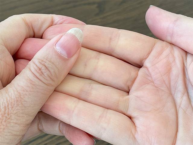 10 ways to improve circulation in your hands | Girl.com.au